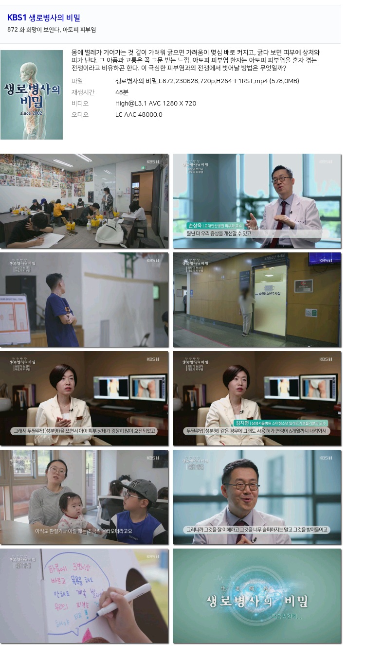 [KBS1] 생로병사의 비밀 희망이 보인다, 아토피 피부염.E872.230628.720p.H264-F1RST 저장 - 파일썬